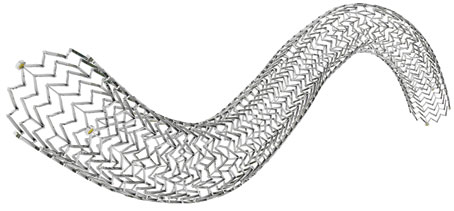Zilver Vena self-expanding venous stent preliminary European results ...