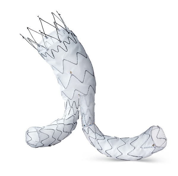 E-tegra AAA Stent Graft System is launched in Europe - Vascular News