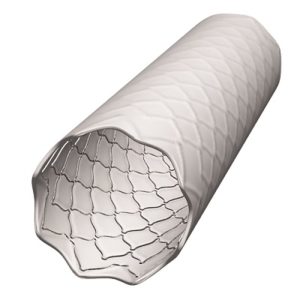 Bentley receives CE mark for new BeGraft aortic stent graft - Vascular News