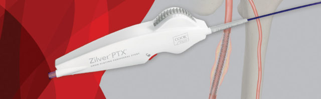 Cook launches 140mm Zilver PTX drug-eluting stent - Vascular News