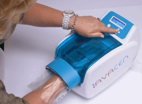 Avacen agrees deal to distribute microcirculation wound healing device ...