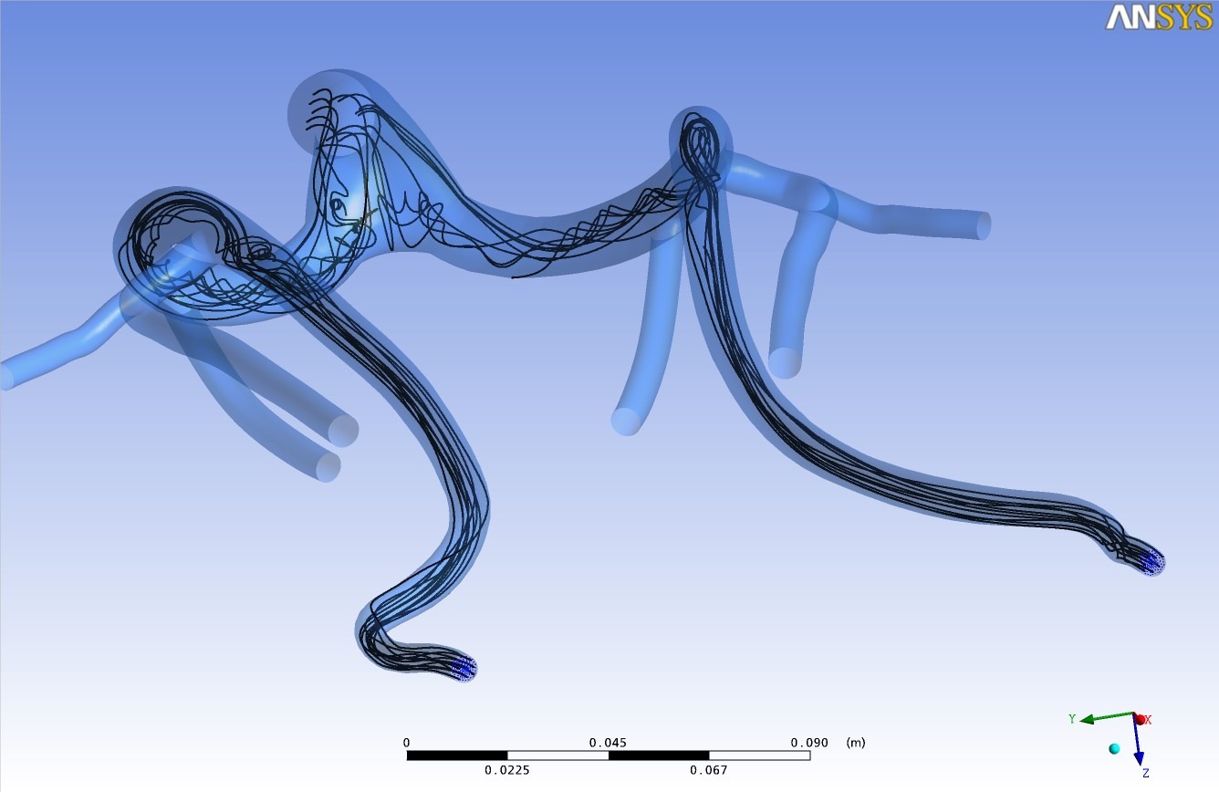 The value of Swirling Flow and the BioMimics 3D clinical study ...