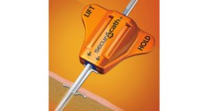 NHS to fast-track SecurAcath device use - Vascular News