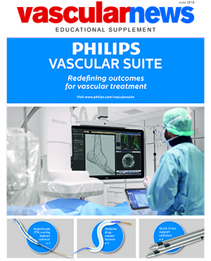 Philips Vascular suite: Redefining outcomes for vascular treatment ...