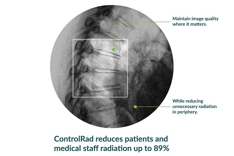FDA clears the only radiation reduction technology that integrates into ...