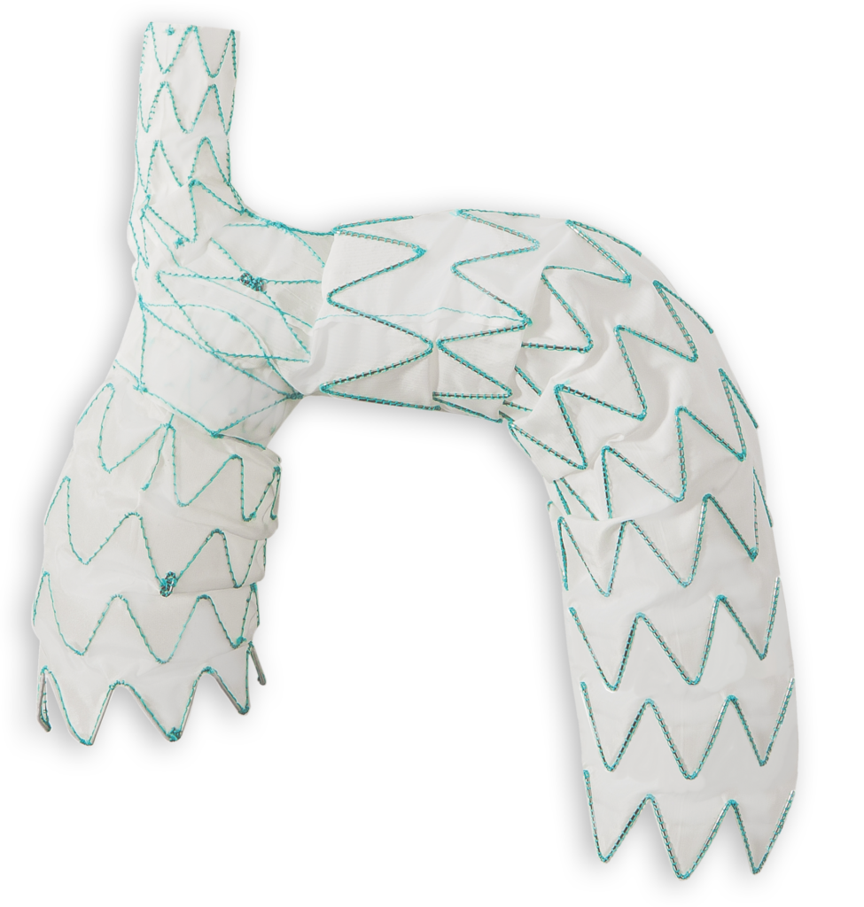 Endospan completes enrolment of primary arm in TRIOMPHE IDE clinical ...