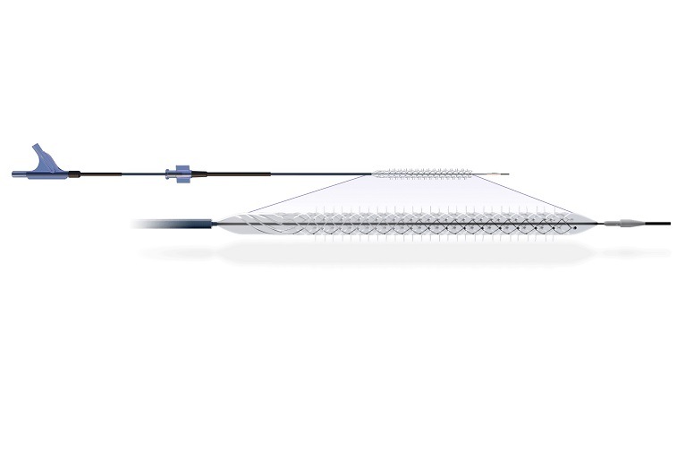 Enrolment begins in DEEPER LIMUS study of Reflow Medical’s Temporary ...