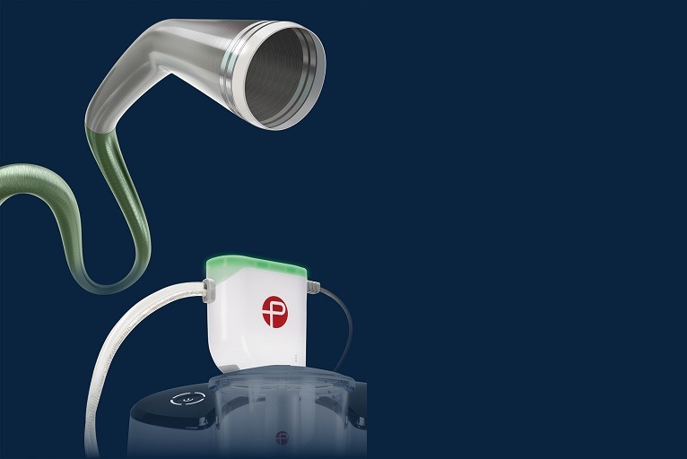 Penumbra augments vascular franchise with latest Indigo System launch ...