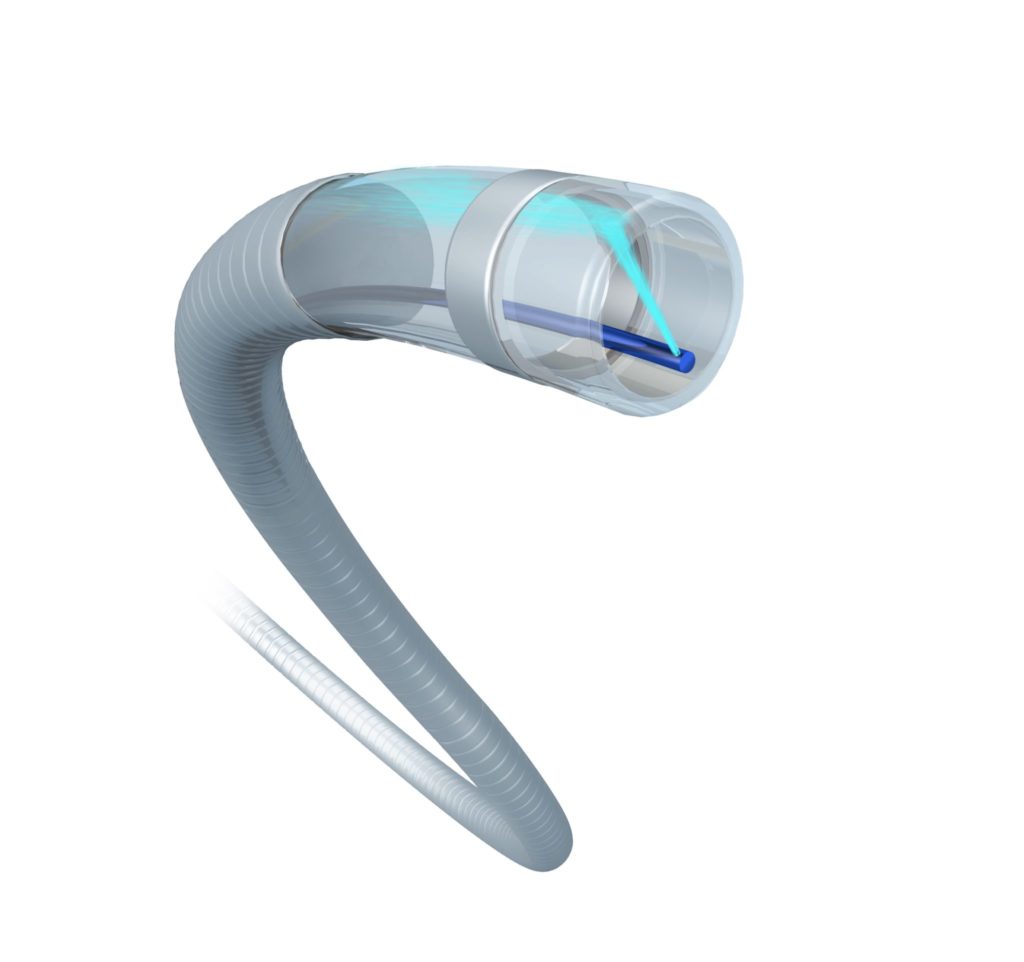 Abbott expands peripheral vascular offerings with acquisition of Walk ...