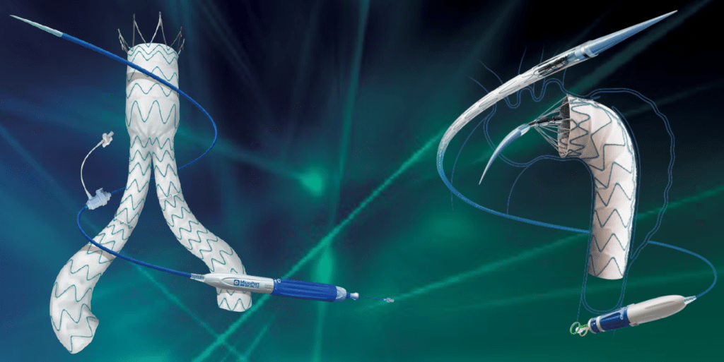 MicroPort’s Minos and Hercules stent grafts now CE marked and available ...