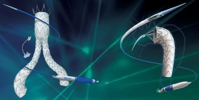 MicroPort’s Minos and Hercules stent grafts now CE marked and available ...