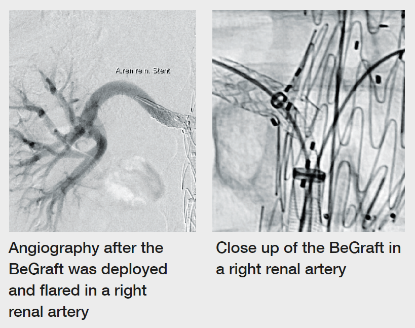 Multicentre, physician-initiated study set to provide key data on ...