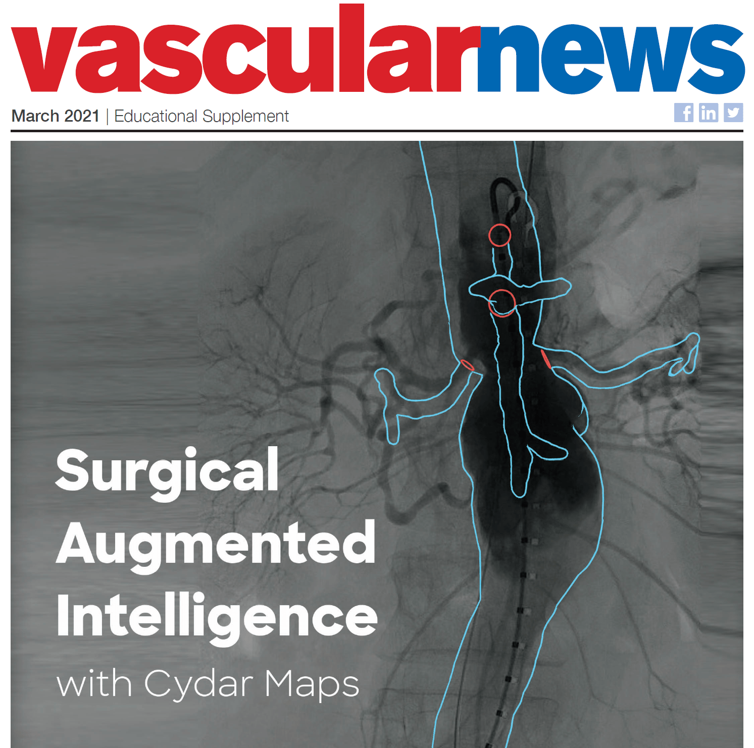 Surgical Augmented Intelligence with Cydar Maps - Vascular News