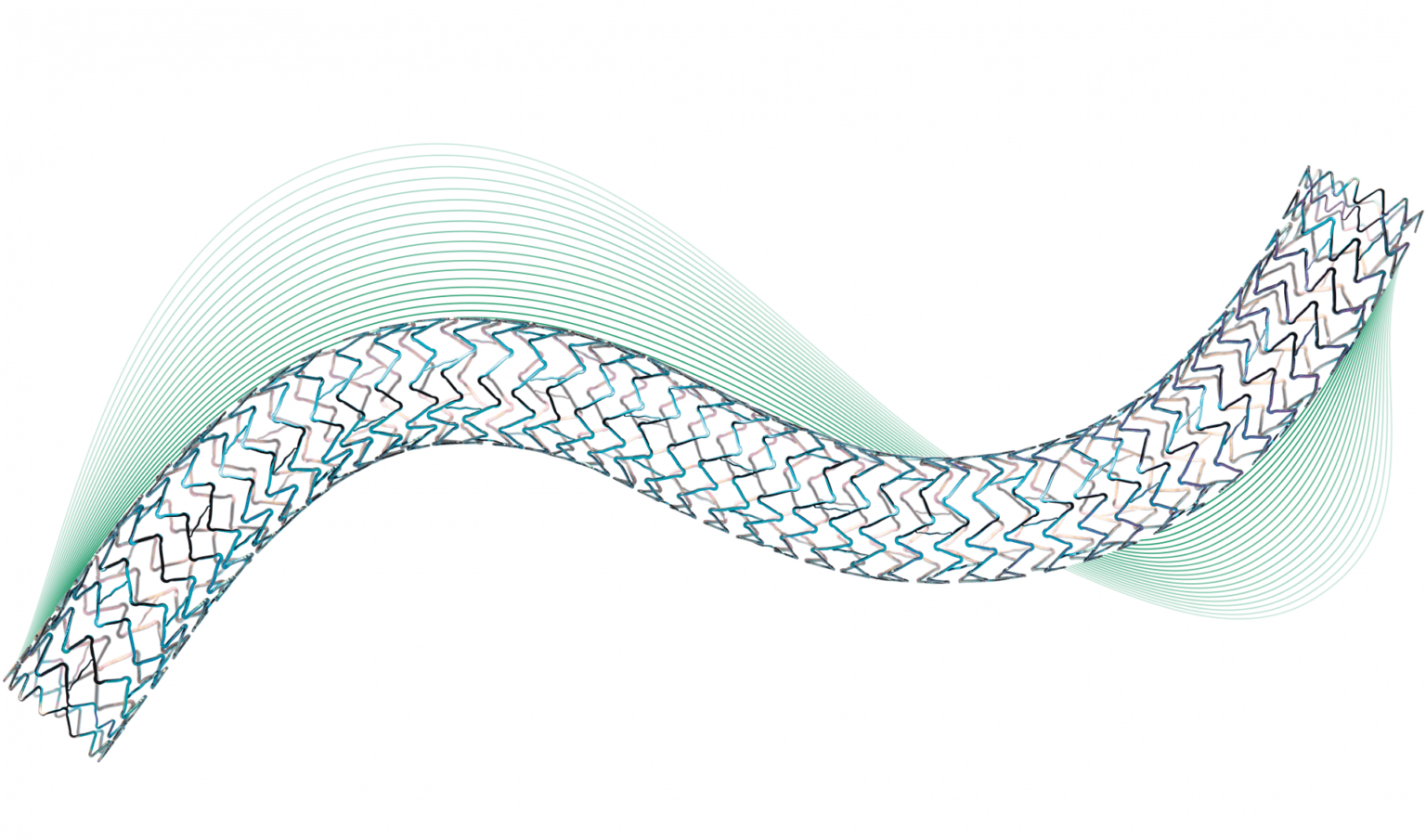 First patient enrolled in BIONETIC-I study of Dynetic-35 stent system