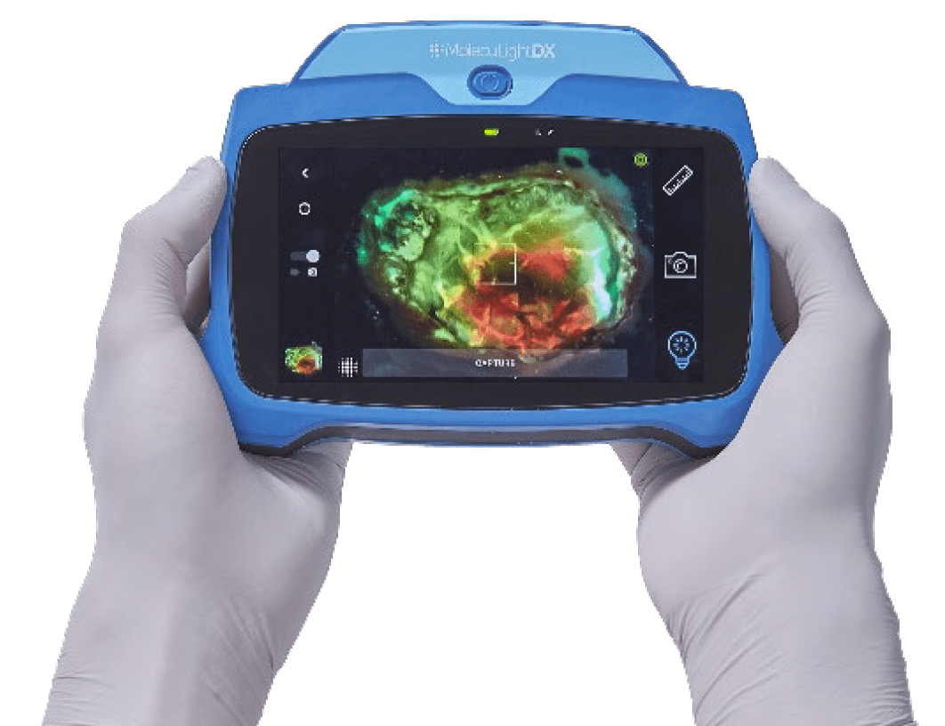 MolecuLight launches DX device