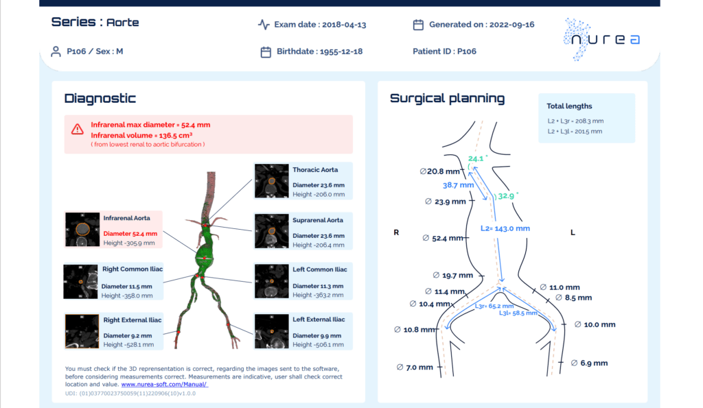 Fully automated software using AI could become a “crucial adjunct” for ...