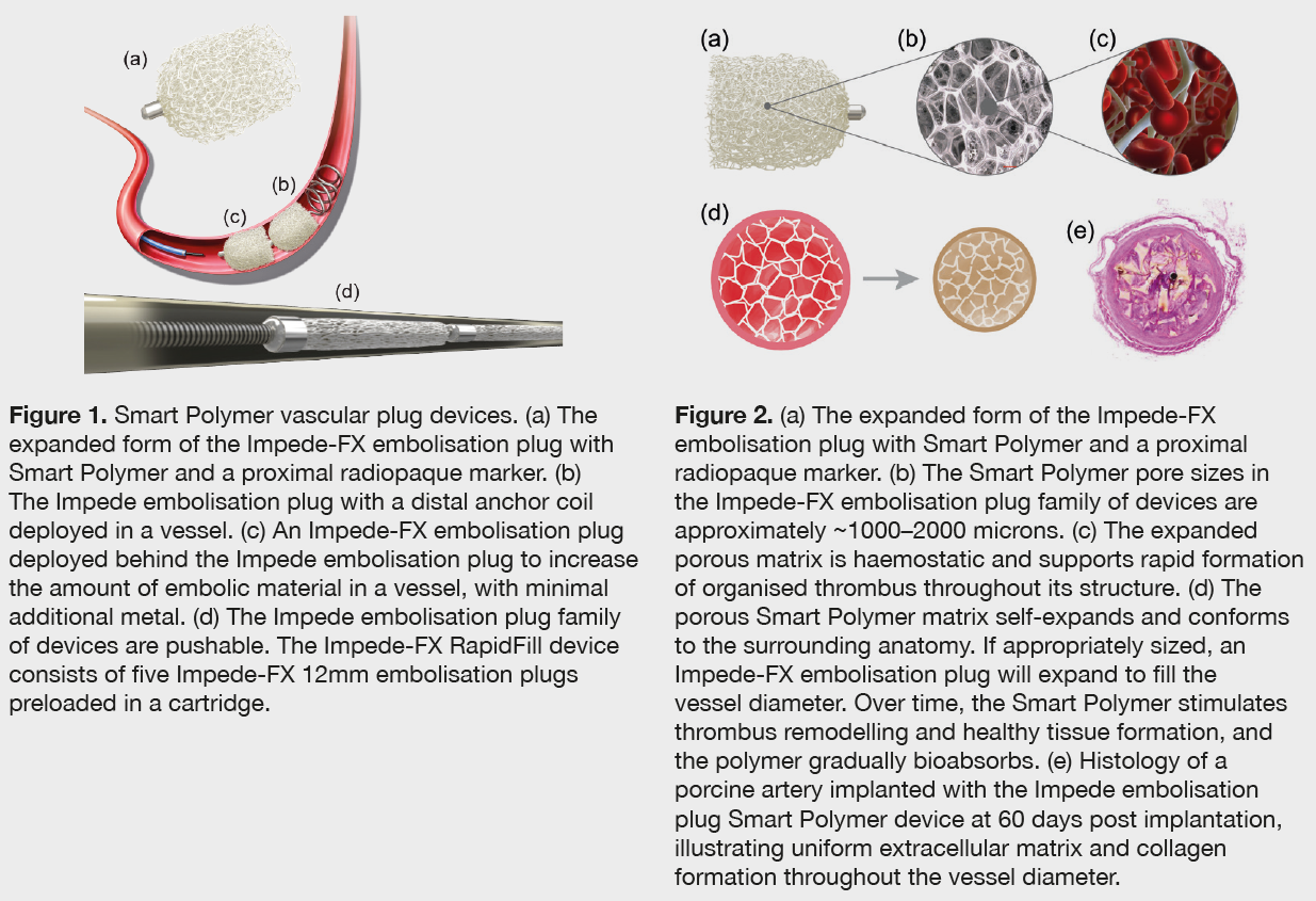 “Promising technology”: An interventional radiologist’s perspective on ...