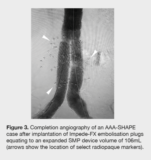 “Promising technology”: An interventional radiologist’s perspective on ...