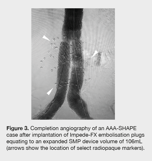 “Promising technology”: An interventional radiologist’s perspective on ...