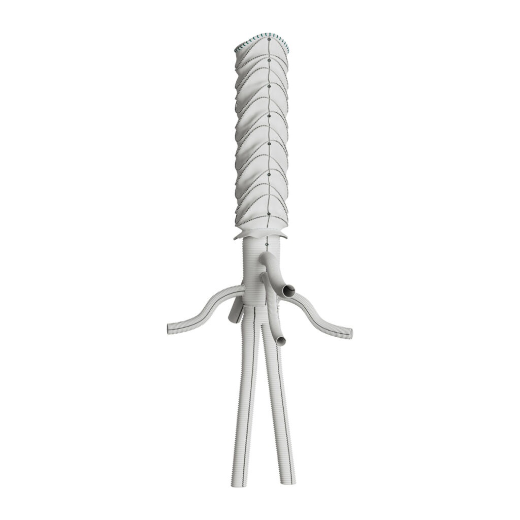 Terumo Aortic announces first implant of Thoracoflo in North America