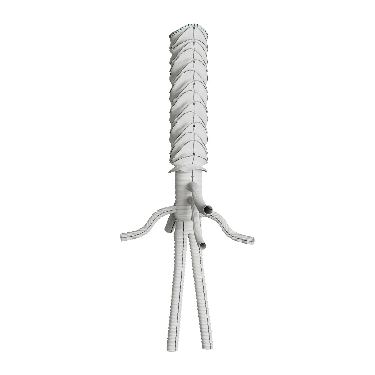 Terumo Aortic announces first implant of Thoracoflo in North America