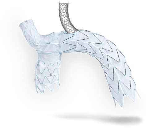 Endospan announces initial experience with Nexus Duo