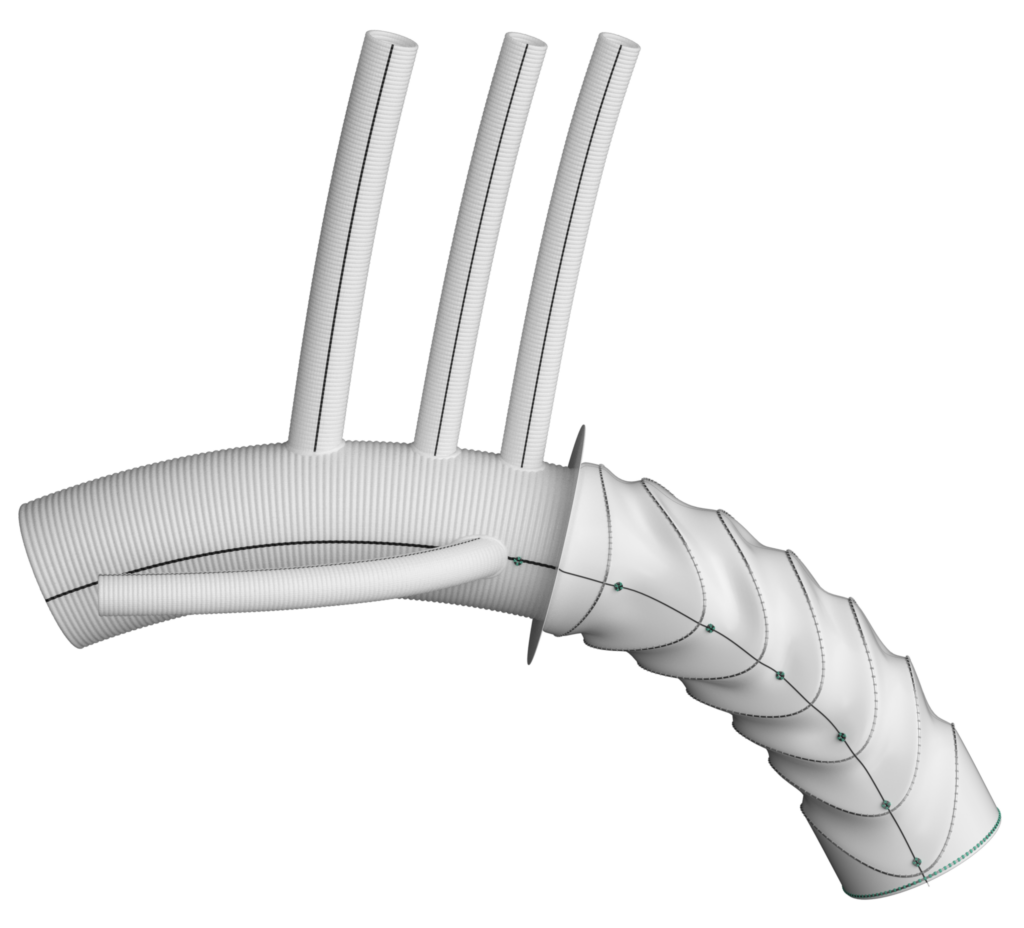Terumo Aortic announces PMDA approval for Thoraflex Hybrid in Japan ...