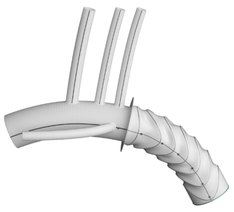 Terumo Aortic announces PMDA approval for Thoraflex Hybrid in Japan ...