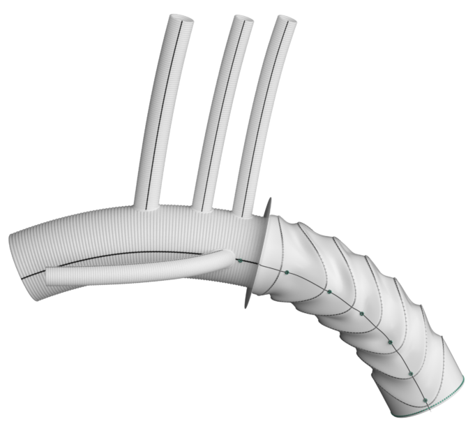 Terumo Aortic announces PMDA approval for Thoraflex Hybrid in Japan ...