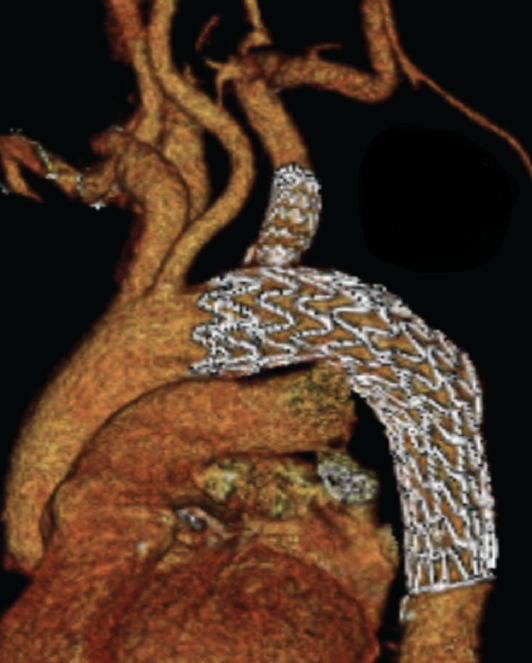 New frontiers in LSA preservation: Dedicated symposium at CX 2024 ...