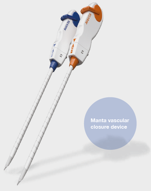 Clinical data and experience point to safety and feasibility of Manta ...