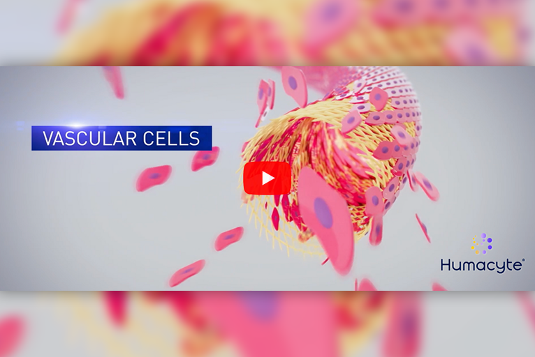 Humacyte pioneers off-the-shelf, universally implantable Acellular ...