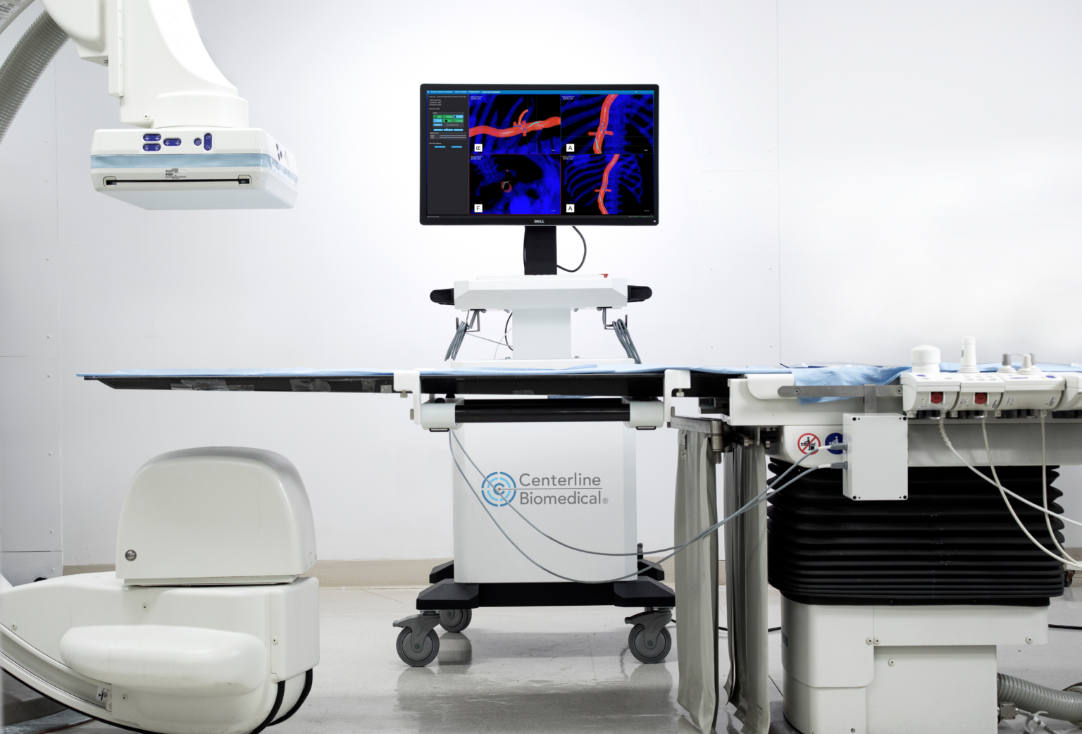 Centerline Biomedical receives US FDA 510(k) clearance for new IOPS ...