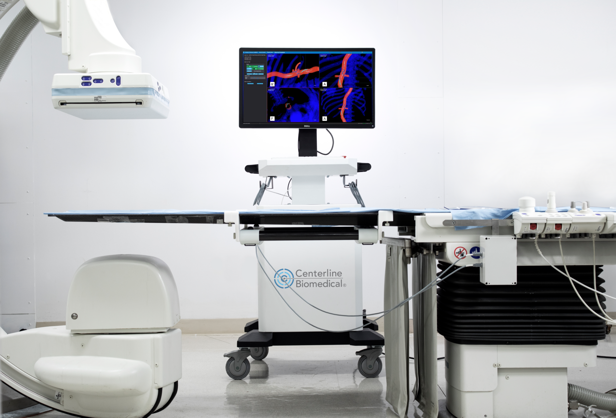 Centerline Biomedical receives US FDA 510(k) clearance for new IOPS ...