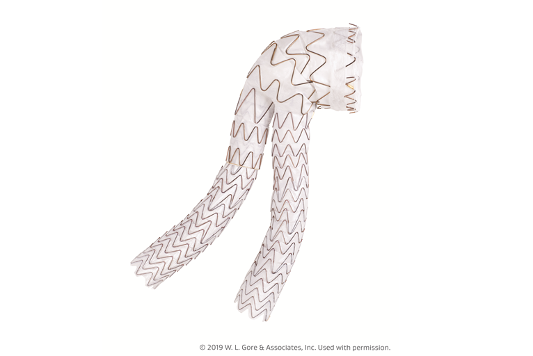 Gore announces first commercial implant of Excluder conformable AAA ...