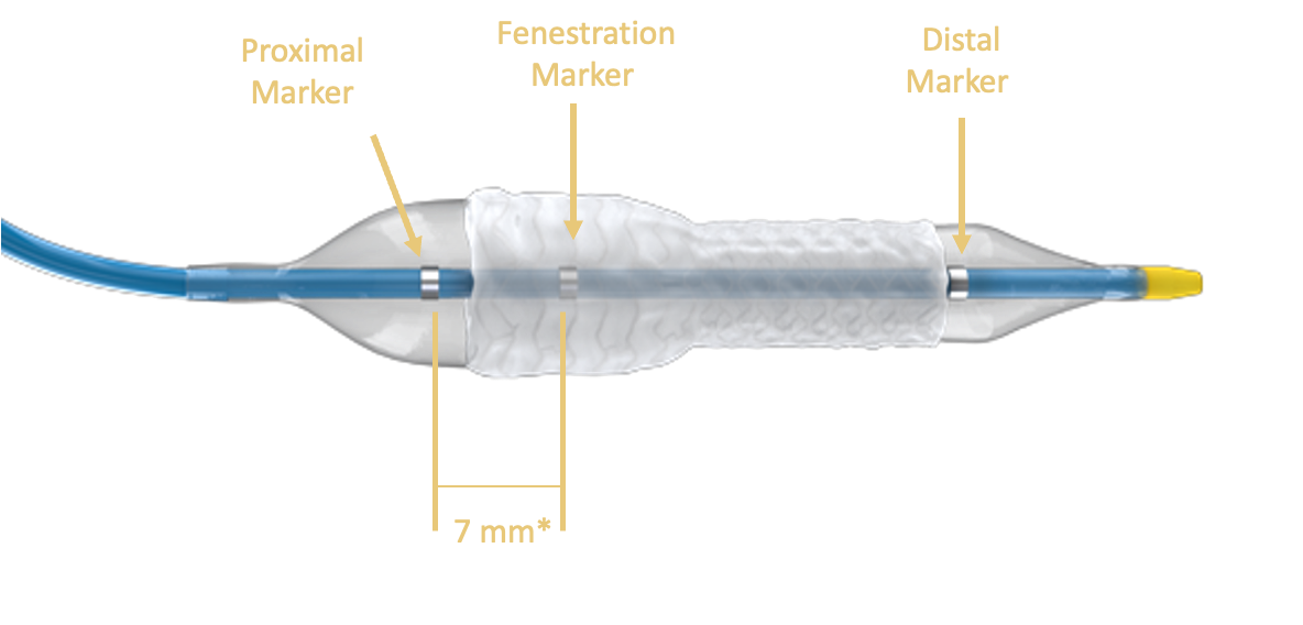 World’s first dedicated FEVAR bridging stent heralds ‘simple, swift and ...