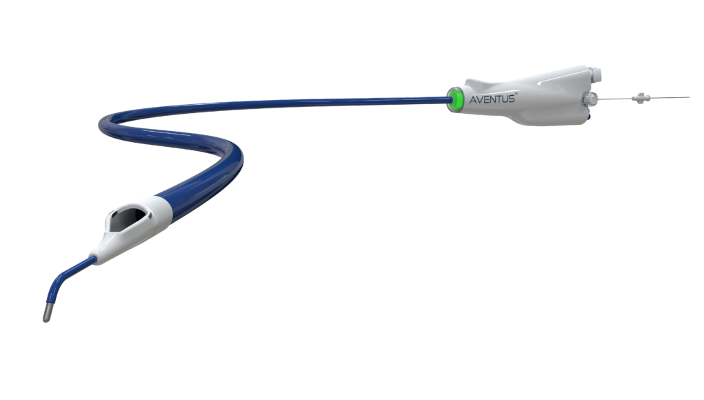 AVENTUS trial of thrombectomy system for PE treatment completes ...