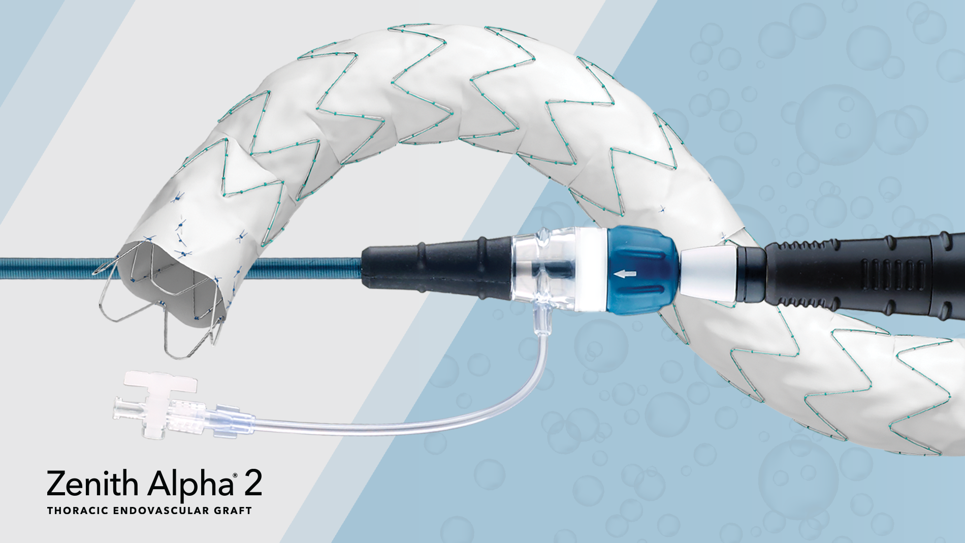 Cook Medical announce first US patient treated with Zenith Alpha 2 ...